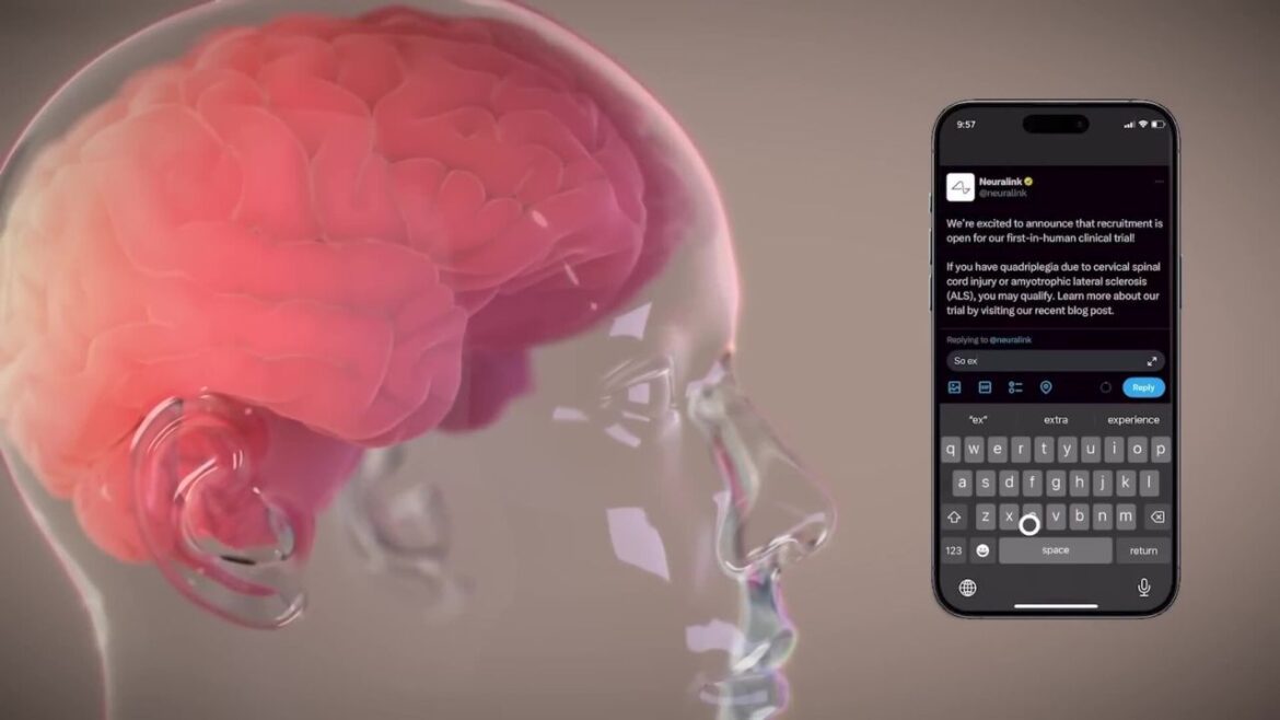 How Elon Musk’s Neuralink brain chip works - CyberGuy
