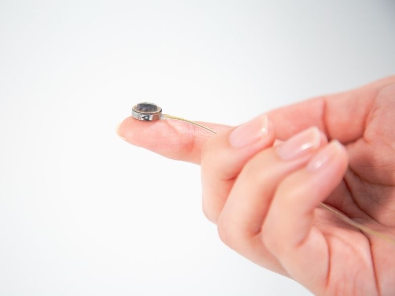 Brain implant for epilepsy tested in 20-minute surgery - CyberGuy
